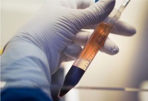 Bone Marrow Mononuclear Cells (BMMCs) – Find high-quality biospecimens ...