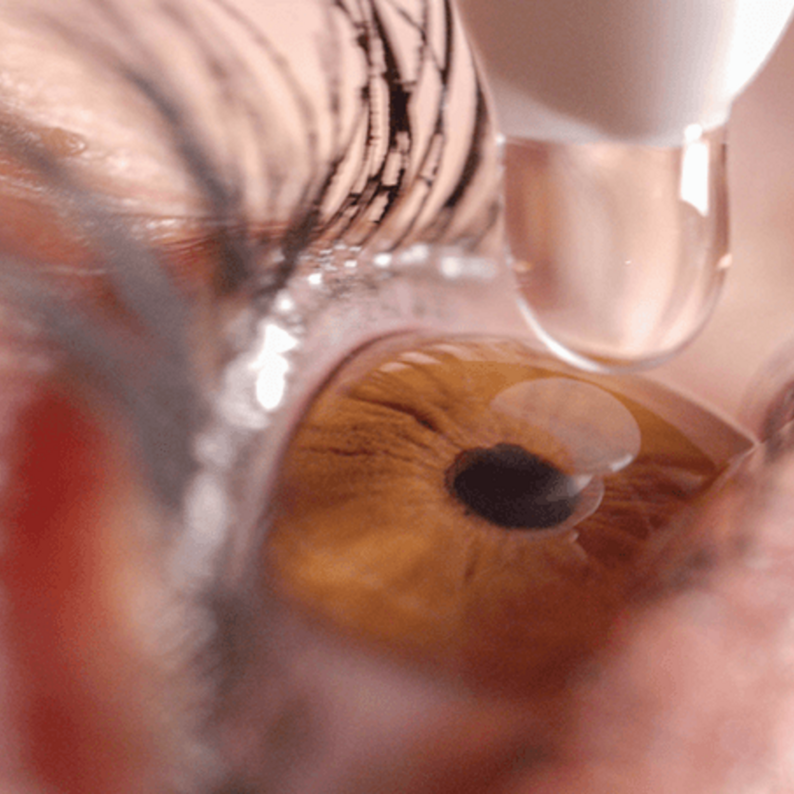 Ocular Fluids – Find high-quality biospecimens including tissues, blood ...